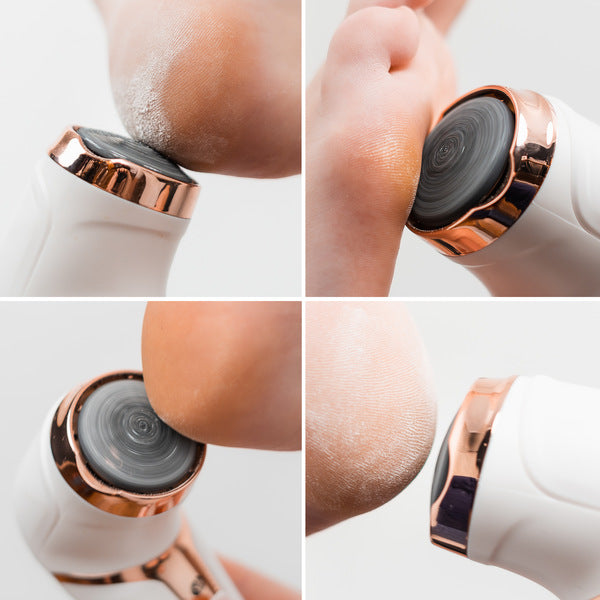 Rio's Foot Files & Hard Skin Removers - A Quick Look At The Benefits ...